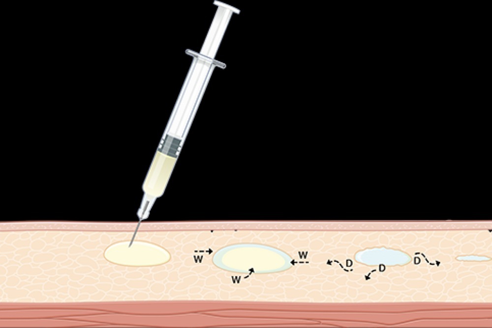 CAMURUS AB: Camurus Receives IND Acceptance From the FDA to Enter Phase ...