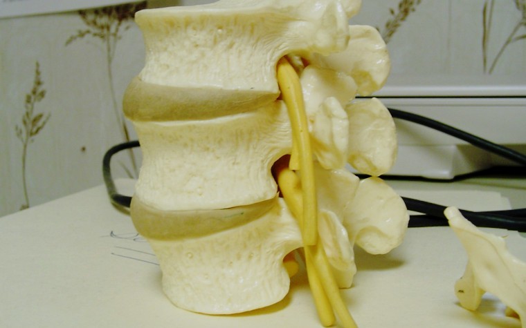 K2M exhibits its Balance ACS platform at International Society for the ...