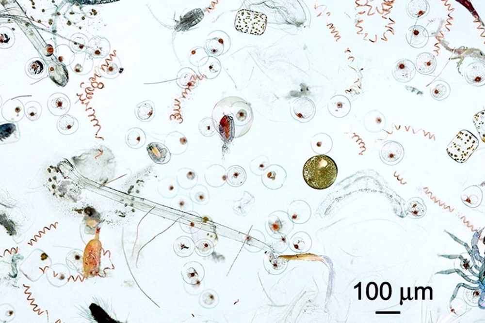 Marine Plankton Tell the Long Story of Ocean Health, and Maybe Human ...