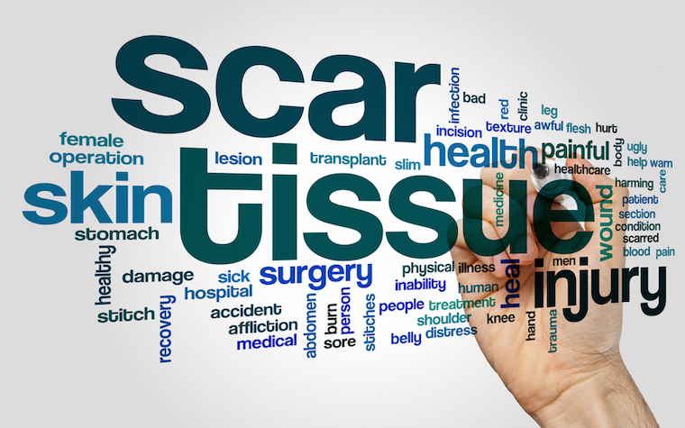 Scientists discover new role for scar tissue on injured spinal cords ...