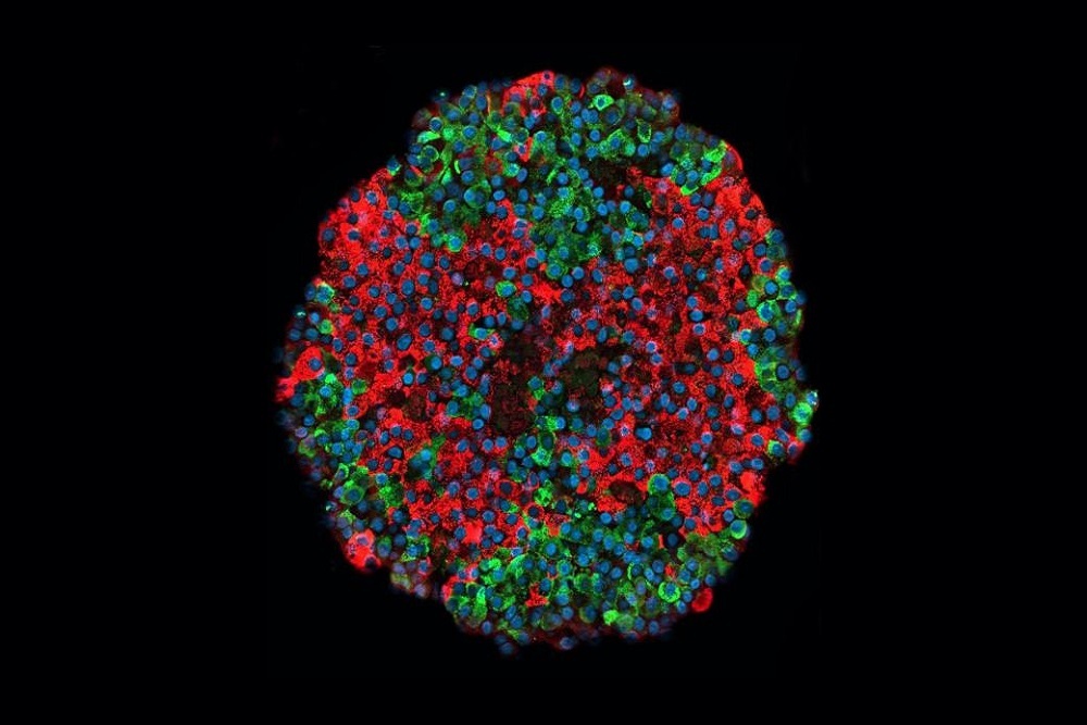 Researchers produce fully functional pancreatic beta cells from stem ...