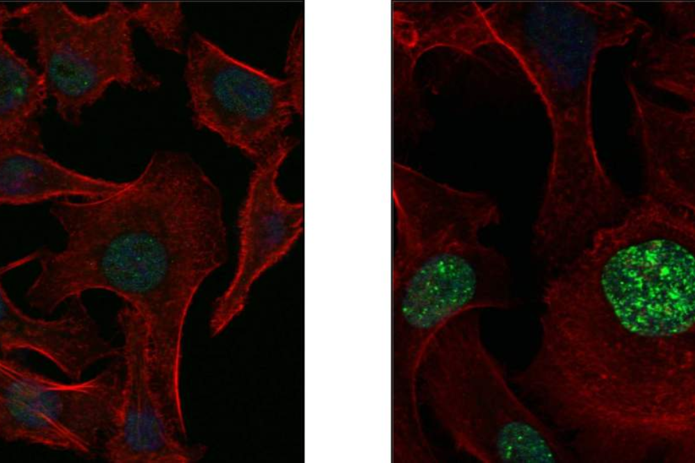 Desperate Cancer Cells | Current Science Daily