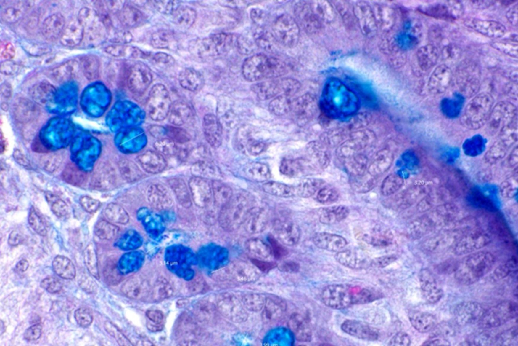 Food Coloring Anti Caking Nanoparticles May Affect Human Gut Current